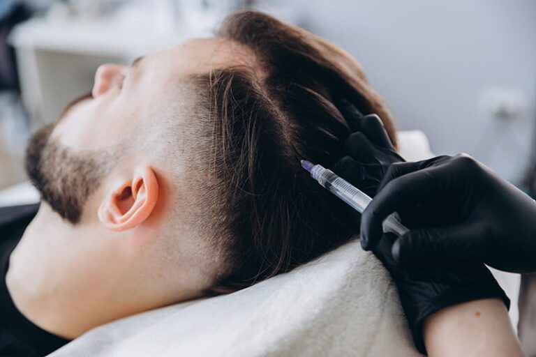 Hair Restoration - Recover Restore Revive